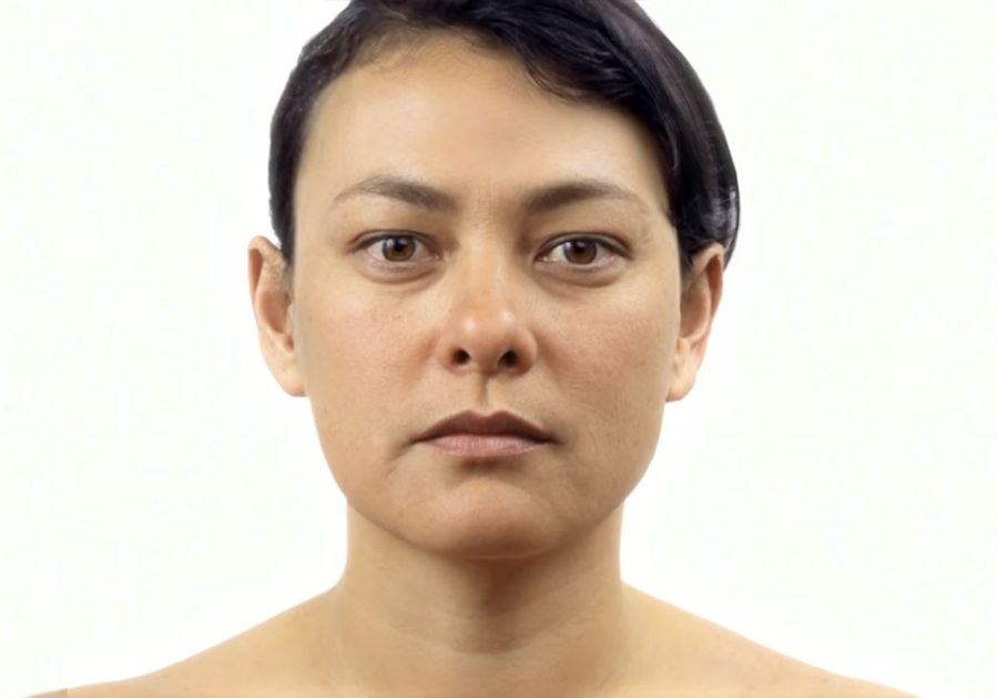 The Ageing Face - Detailed Explanation - The Body Work Clinic